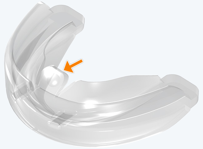 APARATO BUCAL TMJ APPLIANCE | ANDRES H. ARCE S.A